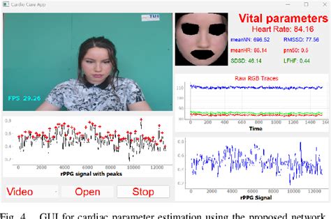 Figure 1 From Timefrequency Learning Framework For Rppg Signal Estimation Using Scalogram Based