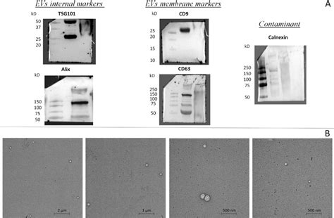 Evs Isolated Pool Of Ff Collected In An And Po Follicles In Both