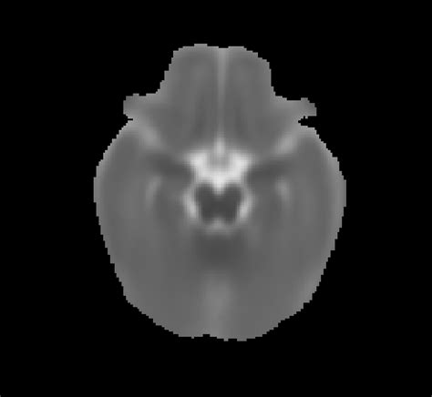 Brain Diffusion Atlas