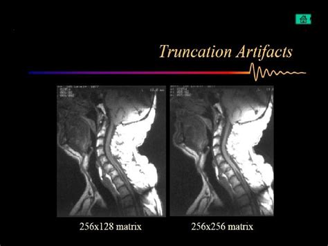 Artifacts In Mri