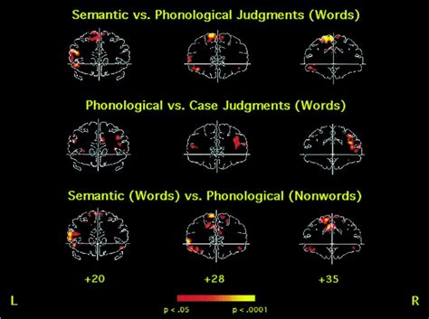 The Role Of The Prefrontal Cortex In Our Cognitive Function The Revisionist