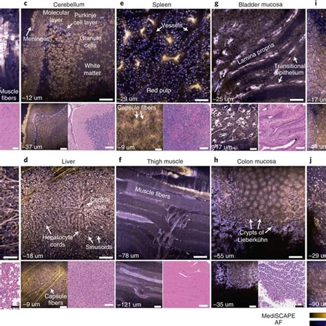 Label Free Imaging Of A Variety Of Fresh Mouse Tissues With