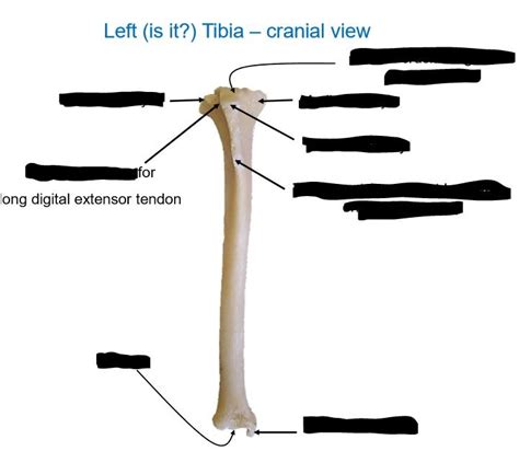Tibia Diagram Quizlet