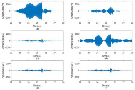 Sensors Free Full Text Reducing Power Line Interference From Semg