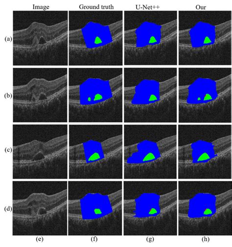 comparison the segmentation results between u net and our models