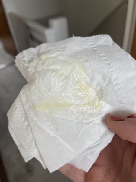 Mucus Plug Pregnancy