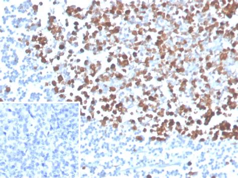 pcna proliferating cell nuclear antigen g1 and s phase marker