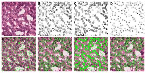 Marker Imposition And Watershed Segmentation For Nuclei Segmentation