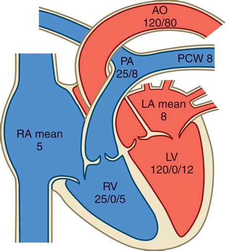 Understanding Hemodynamics Clinical Tree