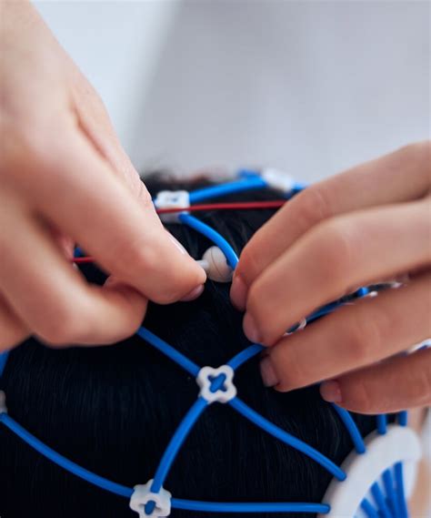 Eletroencefalograma Entenda Como é Feito E A Importância Do Exame Para