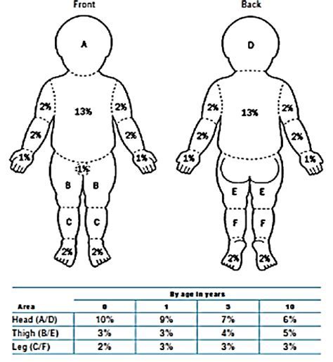 Understanding The Pediatric Burn Chart A Beginners Guide