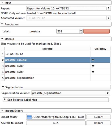 Documentation Extensions Reporting Slicer Wiki