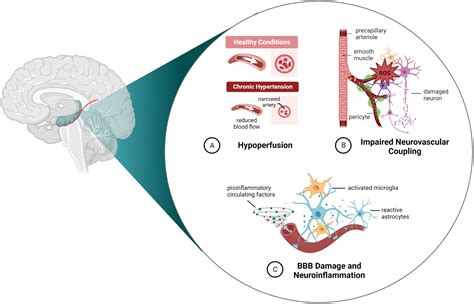 Hippocampal Vascular Supply and Its Role in Vascular Cognitive ...
