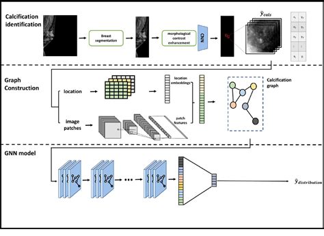 Figure 1 From End To End Calcification Distribution Pattern Recognition For Mammograms An