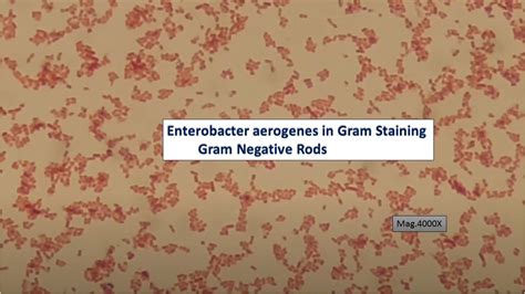 Enterobacter Gram Stain Results