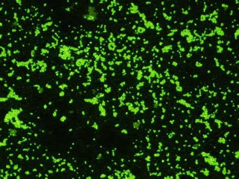 Rabbit Monoclonal Antibody To Group A Strep Clinical Lab Products