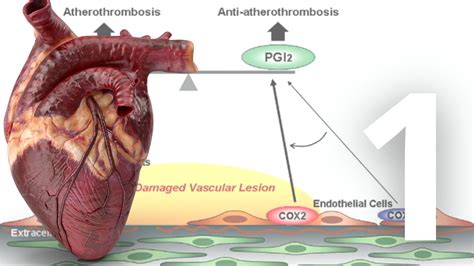 Riesgo Vascular Y Antiinflamatorios No Esteroideos Parte 1 Doryos