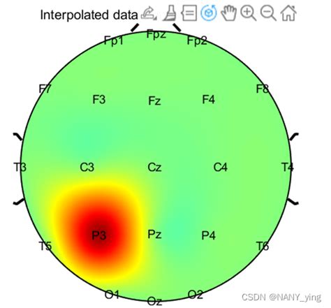 脑地形图（topographicalmapofbrain）以及代码实现 Csdn博客