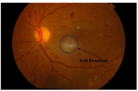 Figure 4 From A Lightweight Robust Deep Learning Model Gained High Accuracy In Classifying A