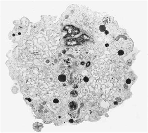 Transmission Electron Microscopy Tem Image Of An Ultrathin Section Of