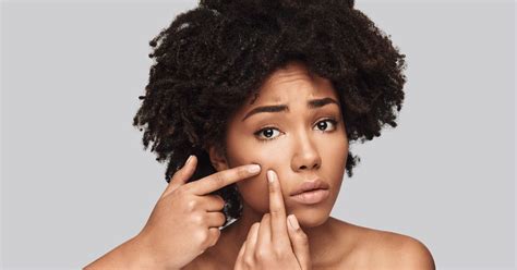 Polycystic Ovary Syndrome Hair The Basics Of Polycystic Ovary Syndrome