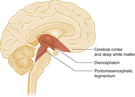 Examination Of The Patient Who Has A Disorder Of Consciousness Neupsy Key