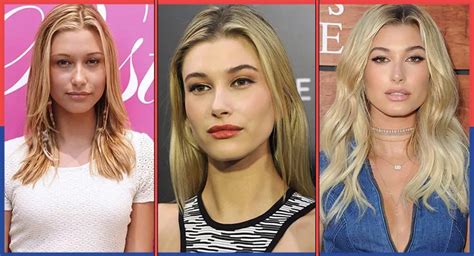 Hailey Baldwin Plastic Surgery Milano Klinik