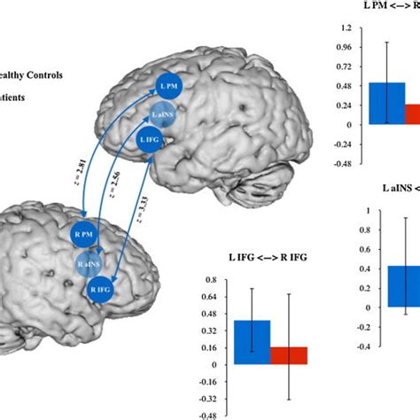 Resting State Connectivity Differences Between Healthy Control Subjects