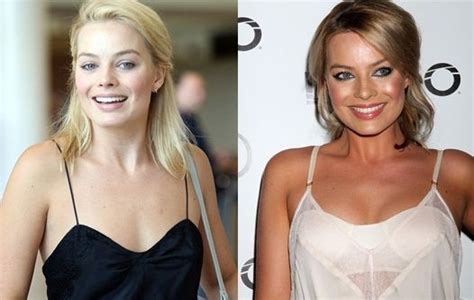 Margot Robbie Plastic Surgery Speculations Celebrities Plastic Surgery