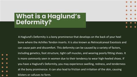 Ppt Haglunds Deformity Treatment In Florida Powerpoint Presentation Id13507038