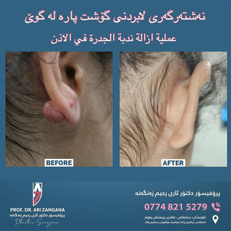 Professor Dr Ari Zangana پرۆفیسۆر دکتۆر ئاری رحیم زەنگەنە