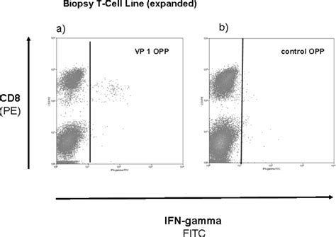 Vp1 Specific T Cells In T Cell Line Derived From Graft Biopsy Vp1 Opp