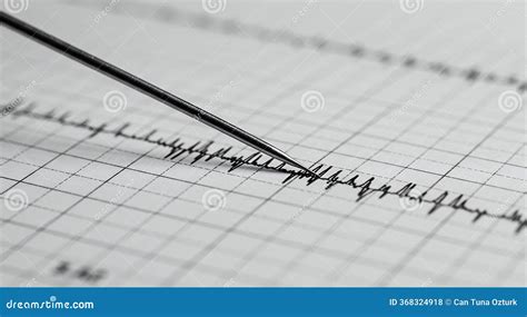An Electrocardiogram Reveals Pattern Of Sinus Tachycardia Fibrillation