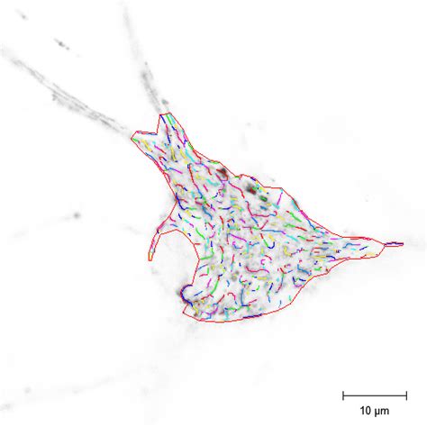 Qualitative Comparison Between Manual And Automatic Segmentation Of