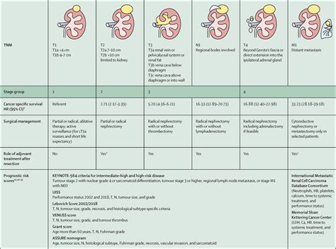 Renal Cell Carcinoma Staging