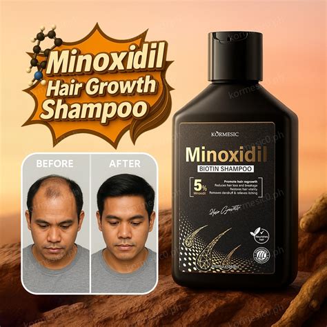 Kormesic 5 Minoxidil Biotin Shampoo 260ml Dht Blocker Anti Hairloss