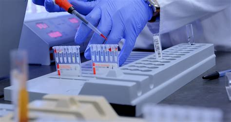 Researchers Encourage Simultaneous Testing For Three Viruses—hiv Hepatitis B Virus Hbv And