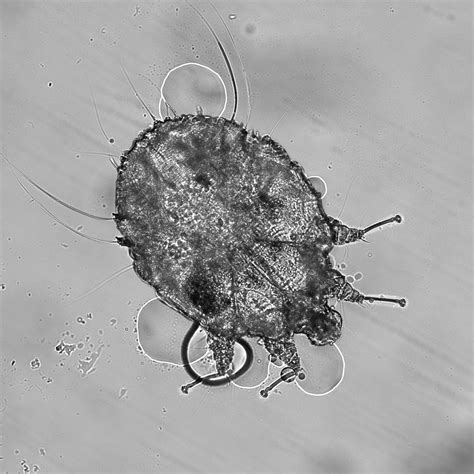 Disease In The Dirt How Mange Causing Mites Decimated A Tasmanian
