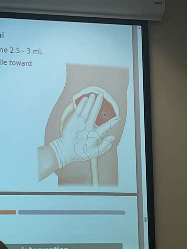 Medication Routes Flashcards Quizlet