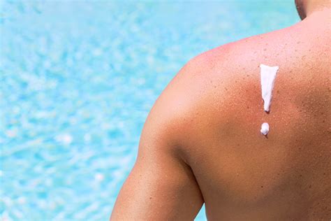 Learn All About Heat Rash Symptoms And Treatment Today