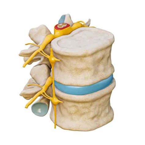 Lumbar Stenosis Carespace Healthwellness