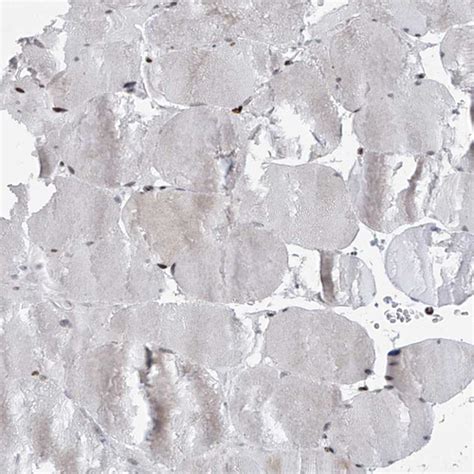 Anti Rfx7 Human Protein Atlas Antibody