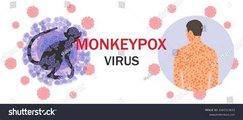 Banner Monkeypox Virus Cells Monkey Silhouette เวกเตอร์สต็อก ปลอดค่า