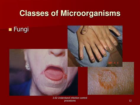 Ppt Classes Of Microorganisms Powerpoint Presentation Free Download