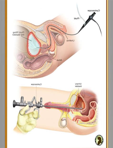 Medical Posters Free Fetish Porn Pic
