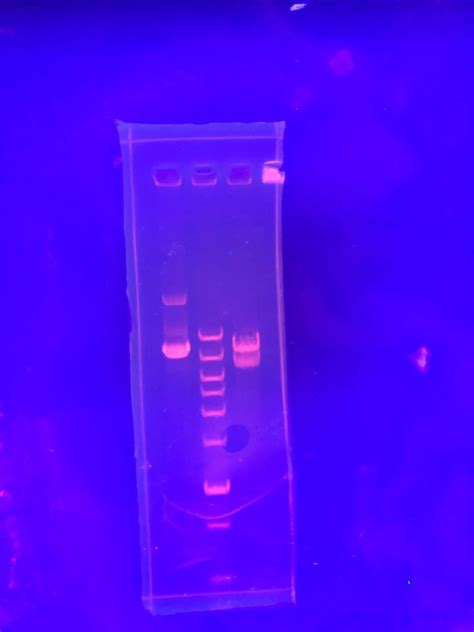 Why The Plasmid Became Smaller After Single Restriction Digestion
