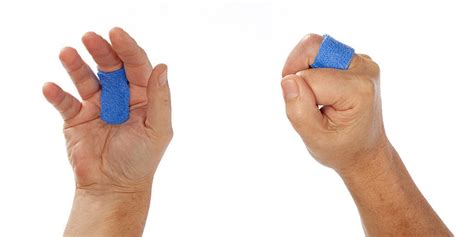 Splinting Hand Therapy Perfect Therapy