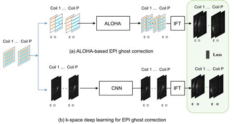 K Space Deep Learning For Reference Free Epi Ghost Correction Deepai