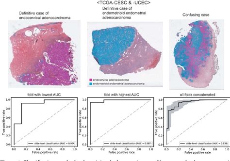 Figure 1 From Deep Learning Based Classification Of Uterine Cervical And Endometrial Cancer