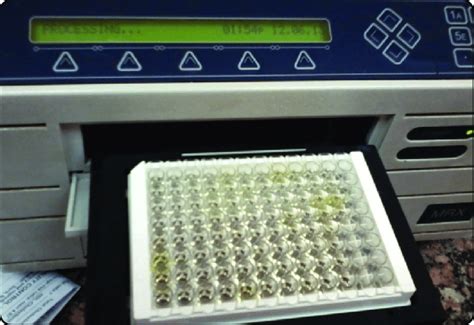 Microplate Reader And Wells Showing Different Optical Density Download Scientific Diagram